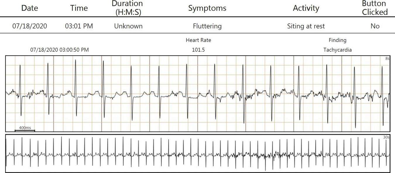 Case Studies - Interventional Cardiologist uses Cardea SOLOTM Wearable ...