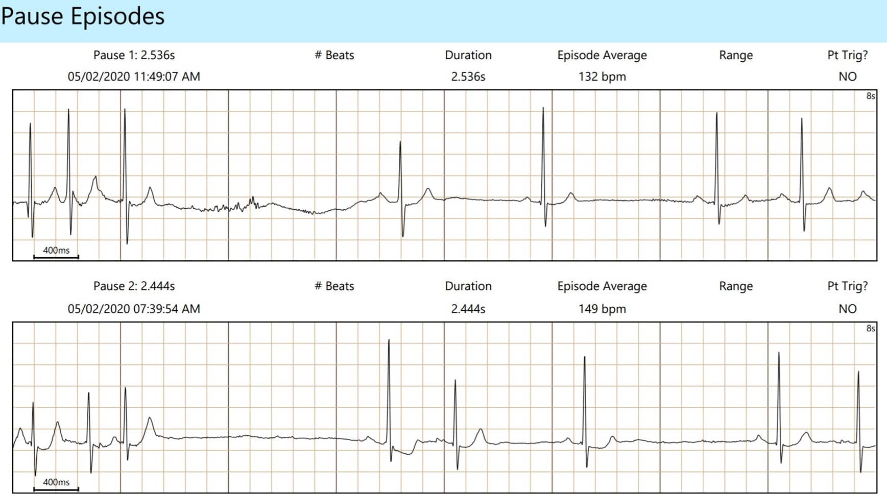 Case Studies - Primary Care Practice detects AF with Cardea SOLO ...